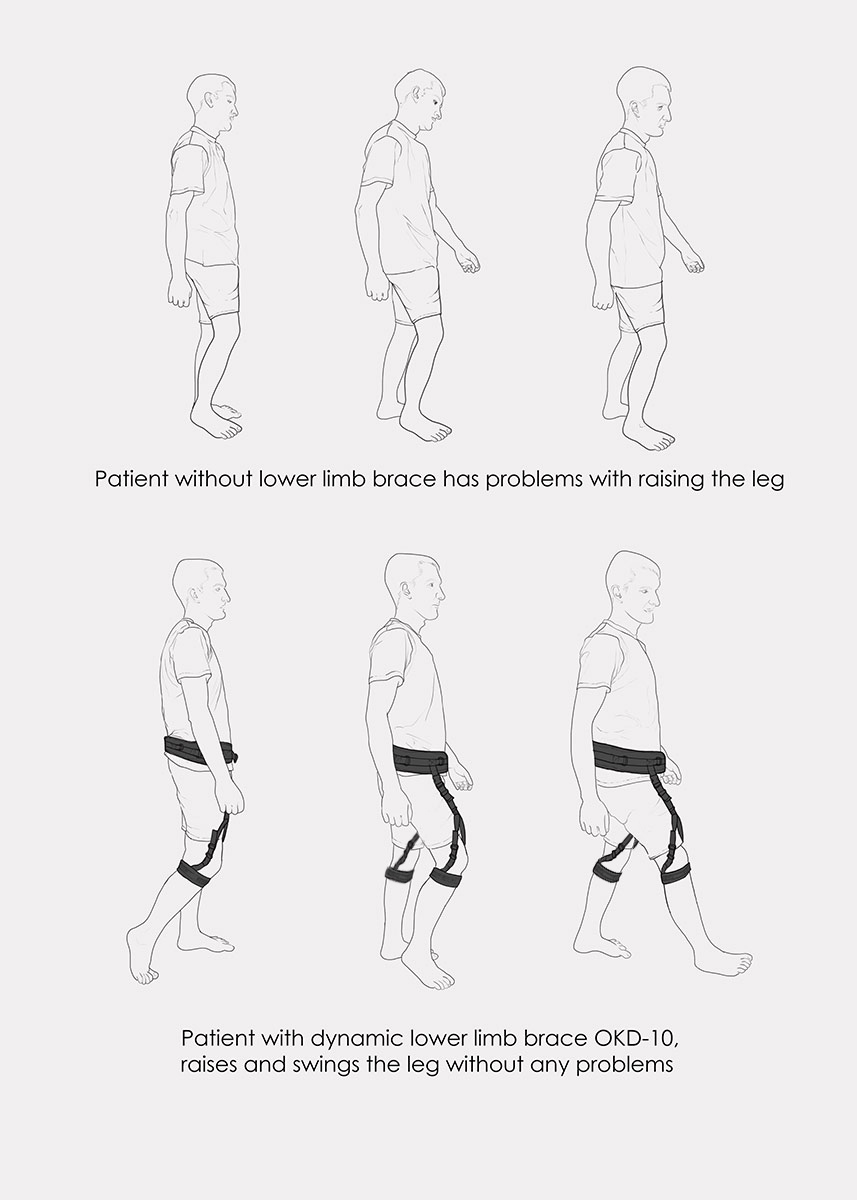 Lower limb support OKD-10 DUAL | Reh4Mat – lower limb orthosis and ...